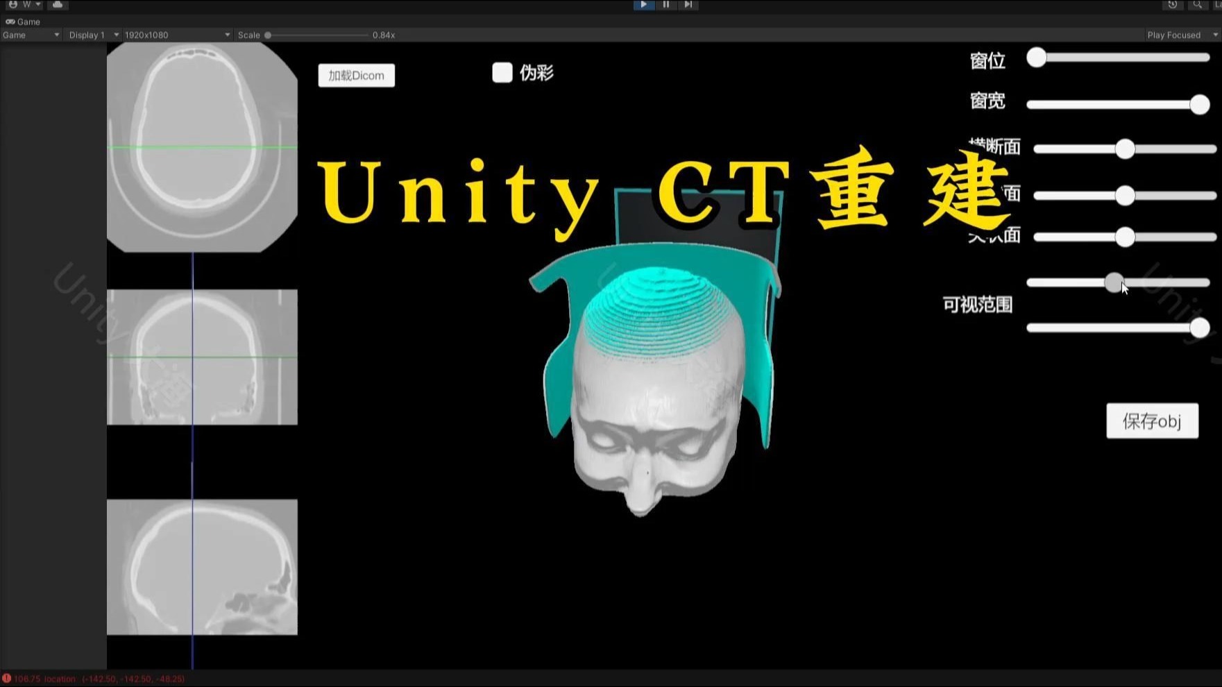 使用了体渲染和MarchingCube算法在Unity中重建CT，ComputerShader非常好用。实现CT导出obj模型。-Unity大海-Unity大海-哔哩哔哩视频