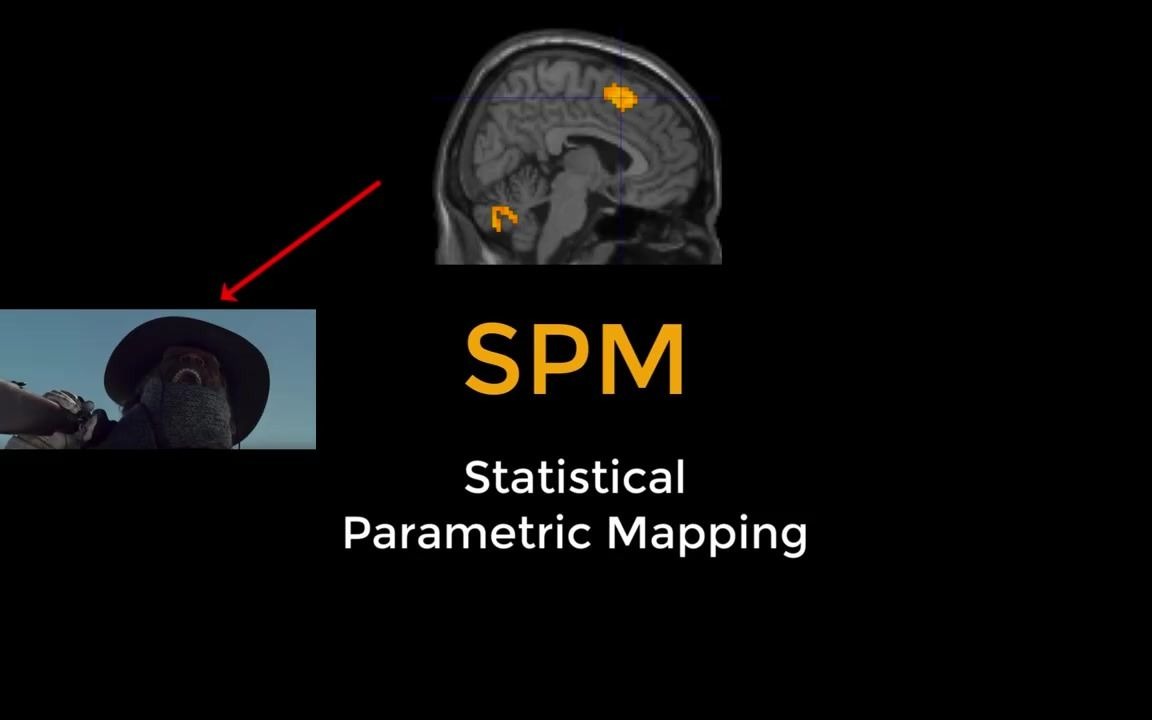 SPM Tutorial #1 SPM Introduction， Download and Install_哔哩哔哩_bilibili