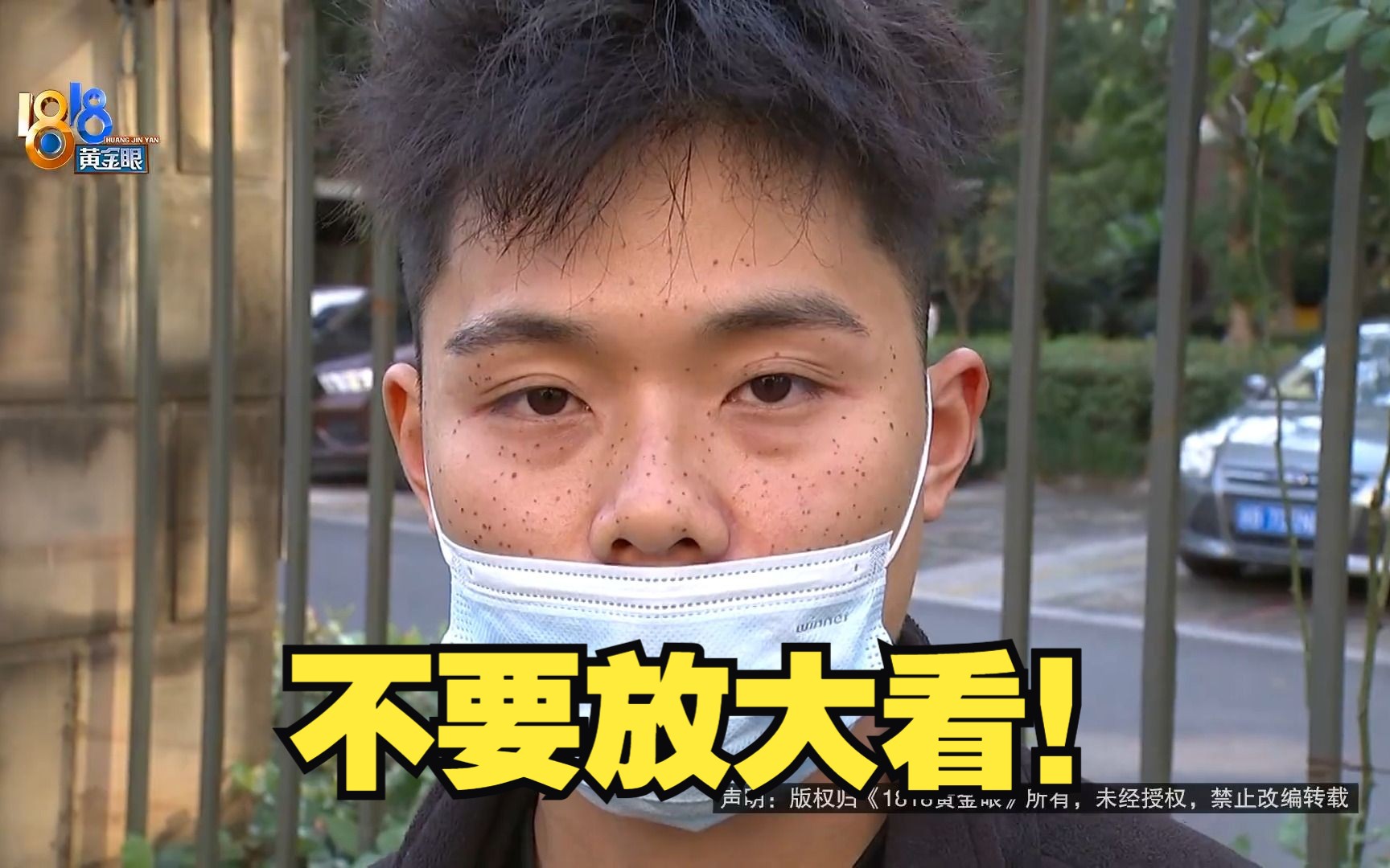 【1818黄金眼】进了 一站式变美中心” 小伙去理发被推荐祛斑充一万块 1818黄金眼 1818黄金眼 哔哩哔哩视频