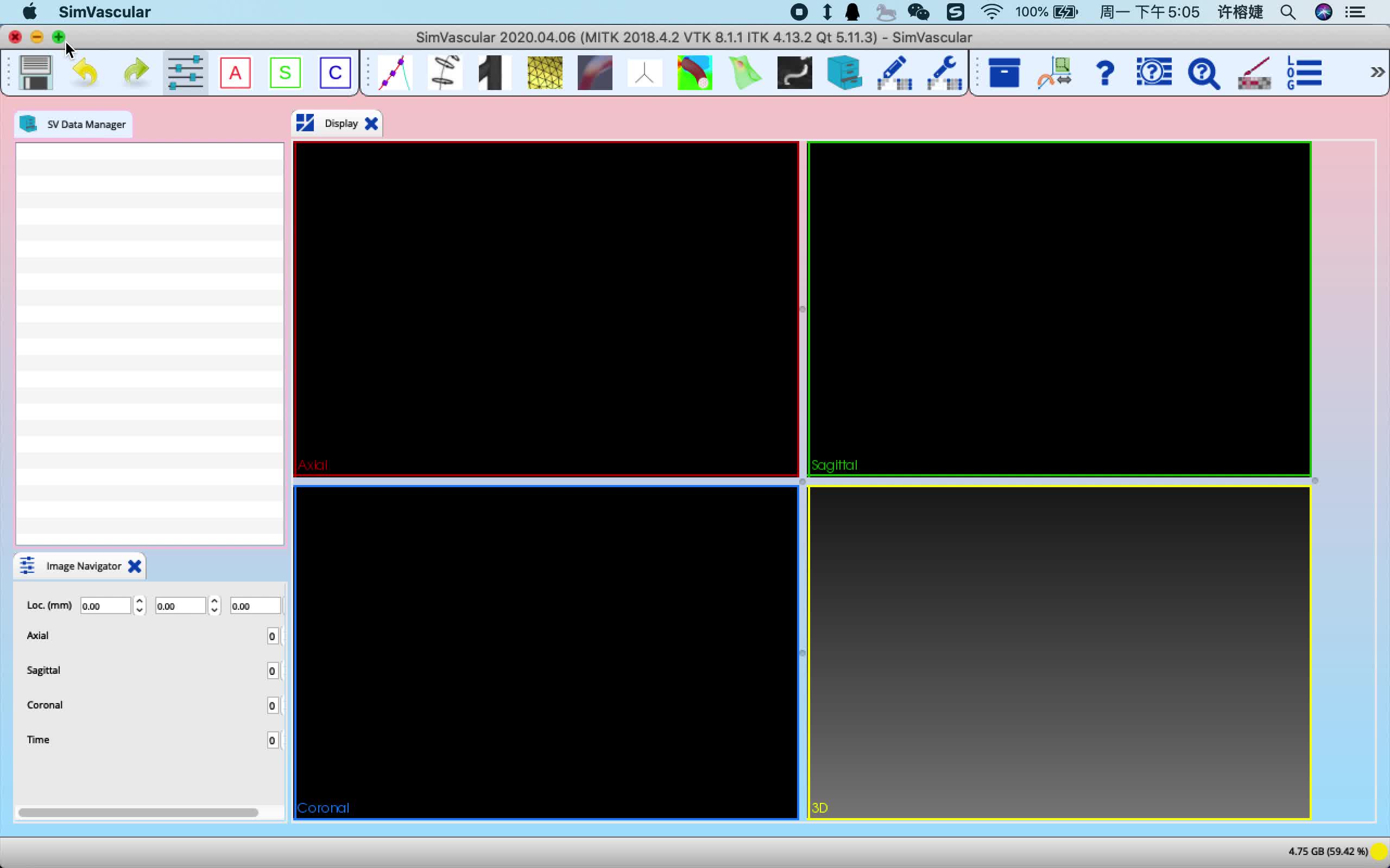 SimVascular教程一：创建项目并导入影像序列_哔哩哔哩_bilibili