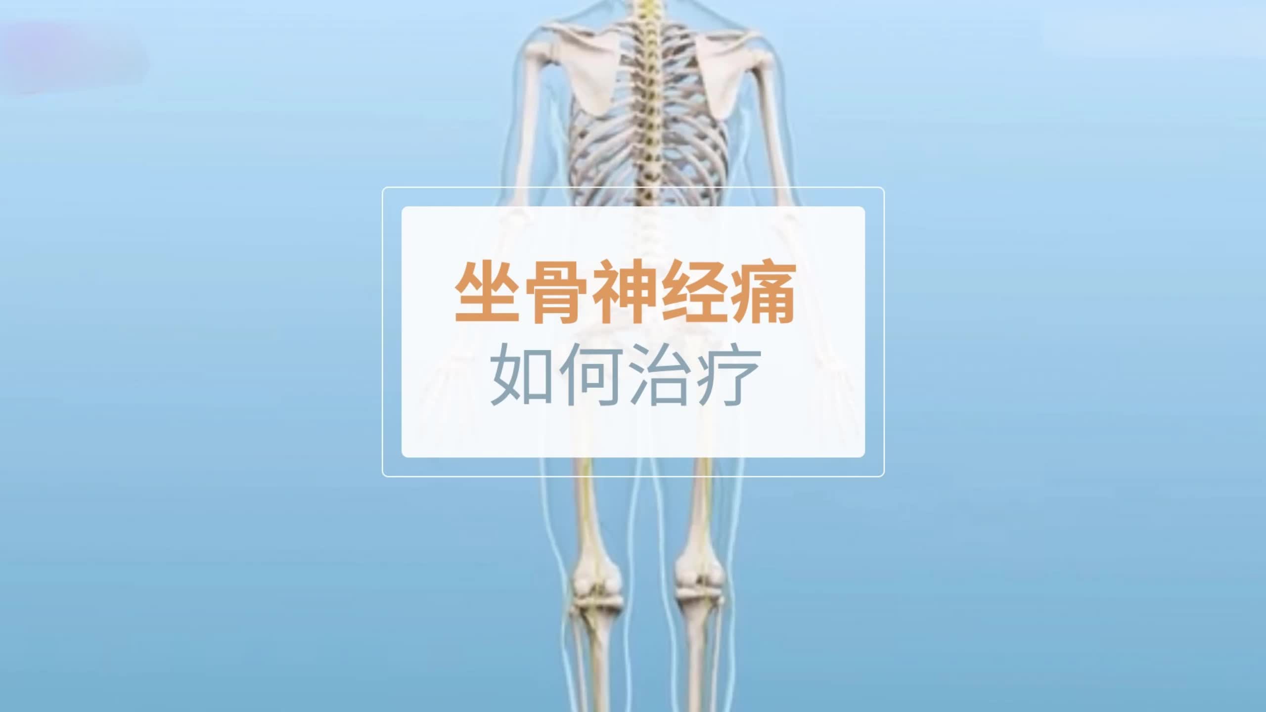 可喜安:坐骨神经痛如何治疗 喜喜一家人 喜喜一家人 哔哩哔哩视频