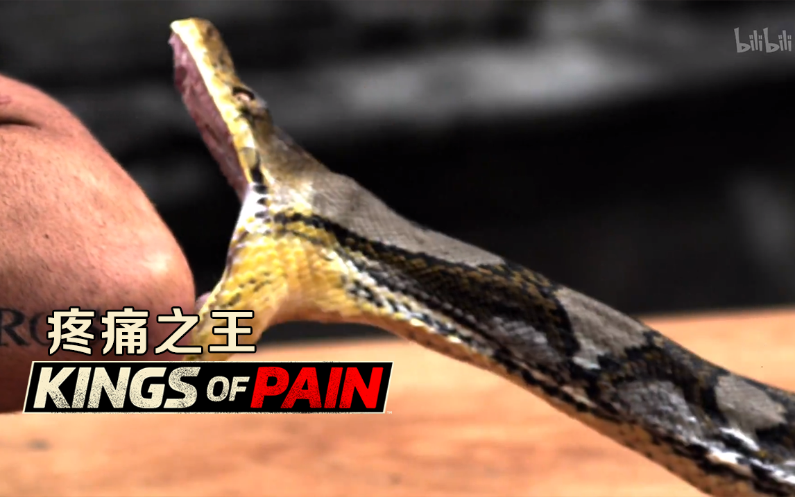 疼痛之王第6集-纪录片-全集-高清独家在线观看-bilibili-哔哩哔哩