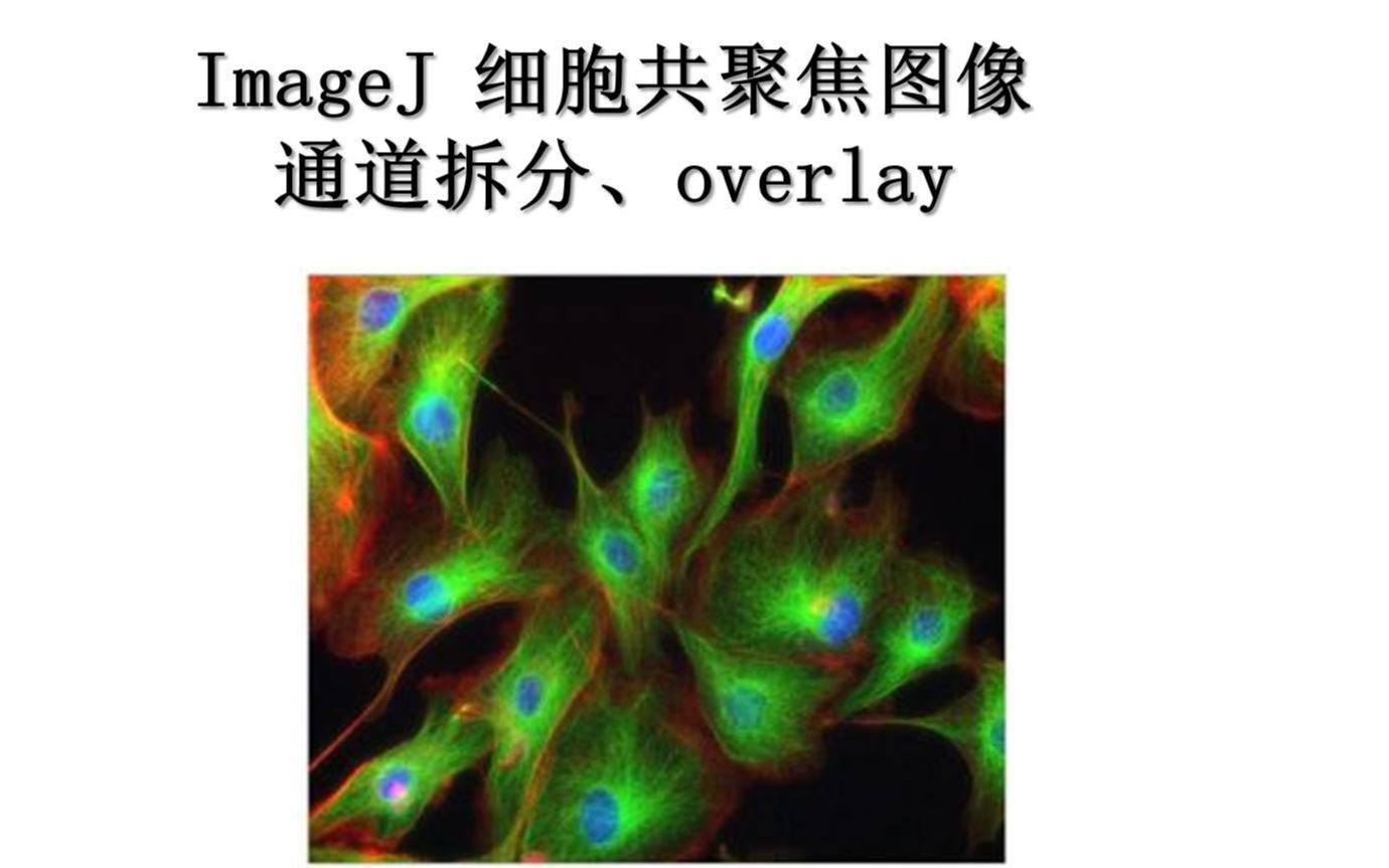 【科研绘图】ImageJ细胞共聚焦图像通道拆分和merge/overlay通道叠合_哔哩哔哩_bilibili