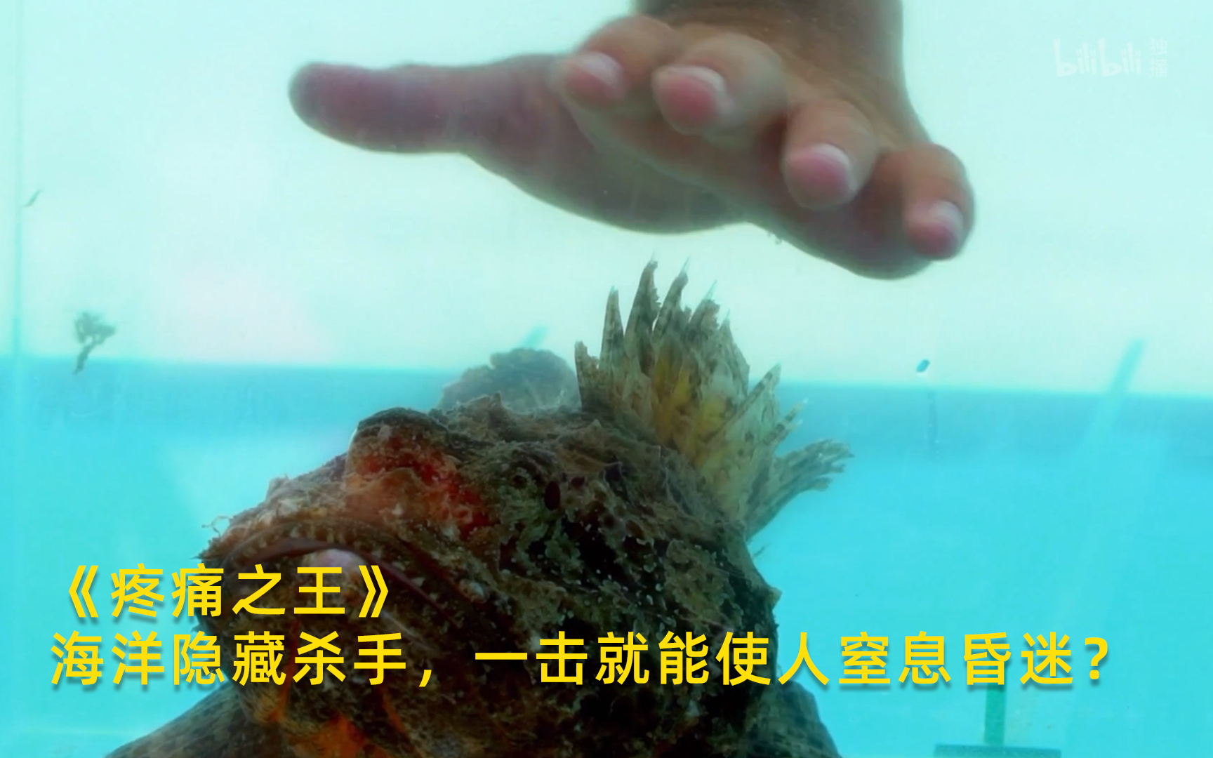 疼痛之王看点13-纪录片-全集-高清独家在线观看-bilibili-哔哩哔哩