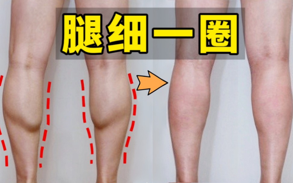 【有效瘦小腿】4招改善肌肉腿、脂包肌,消除水肿酸胀,拉伸小腿线条! 哔哩哔哩