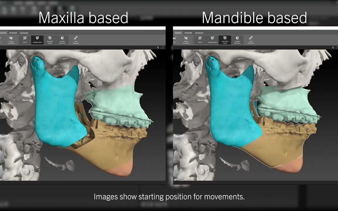 Workflow 6 - Plan Movement _ IPS CaseDesigner® Tutorial_哔哩哔哩_bilibili