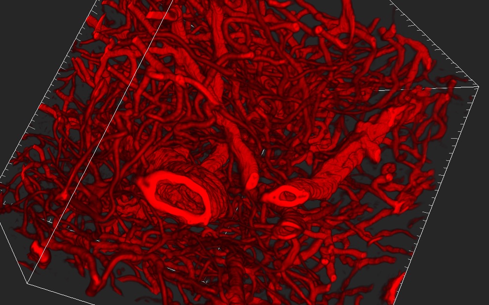 Analysis of Vasculature-Combining multiple Imaris detection modes ...