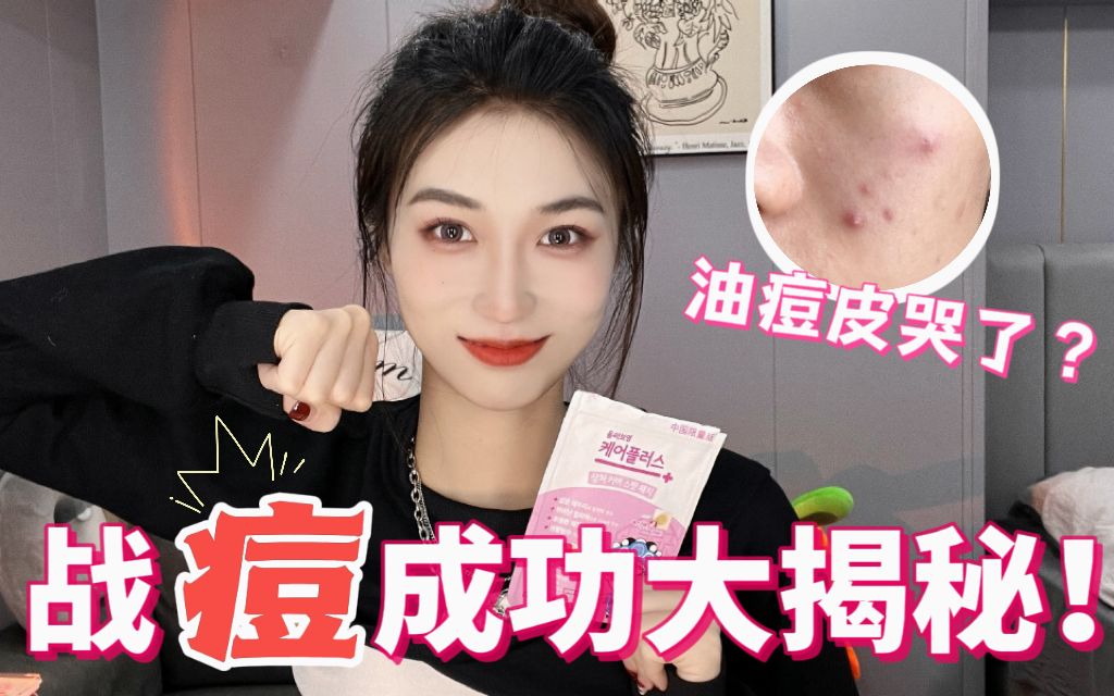10年战痘经验分享！如何真正有效祛痘？油痘肌的一定要看！ 哔哩哔哩