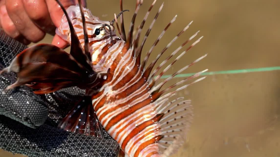 疼痛之王看点3-2-纪录片-全集-高清独家在线观看-bilibili-哔哩哔哩