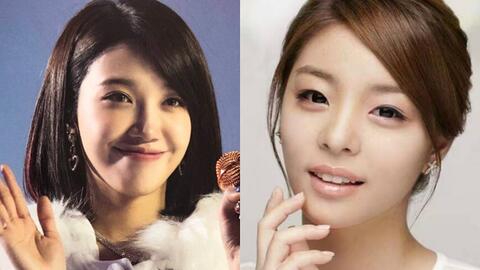 Ailee Plastic Surgery Before And After