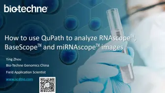 ACD RNAscope在眼睛发育，功能与疾病研究中的应用_哔哩哔哩_bilibili