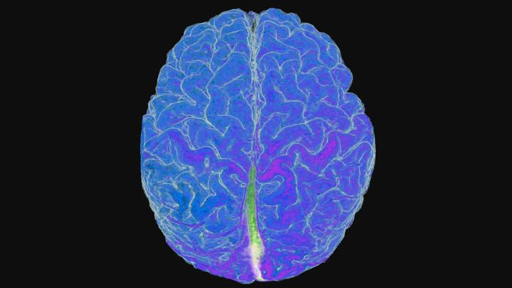 Chubbyemu的动态 - 哔哩哔哩