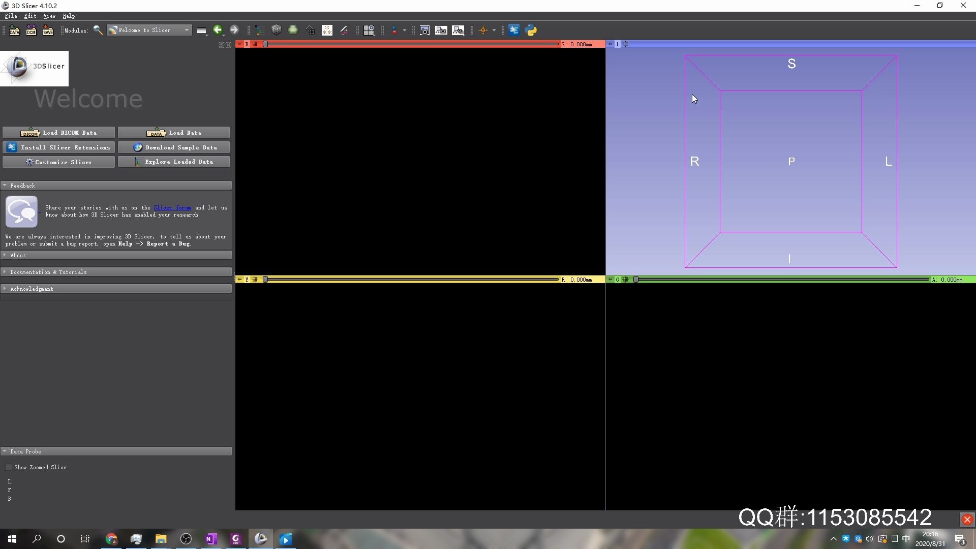 3D Slicer 数据导入 2020-08-31_哔哩哔哩_bilibili