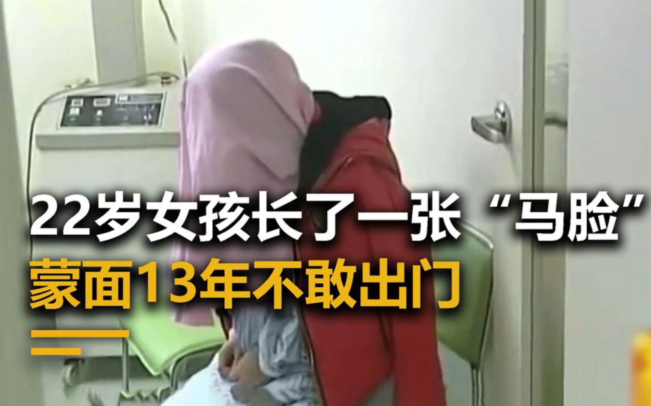 22岁女孩长了一张“马脸”,蒙面13年不敢出门,医生看完直呼可怕 哔哩哔哩