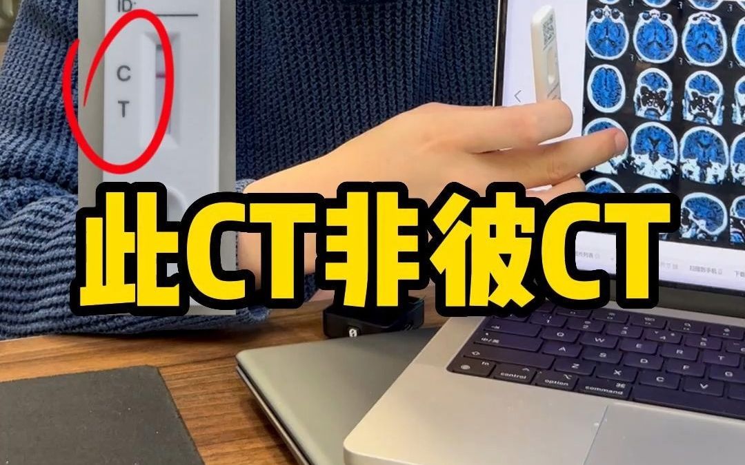 CT CT ct-ct