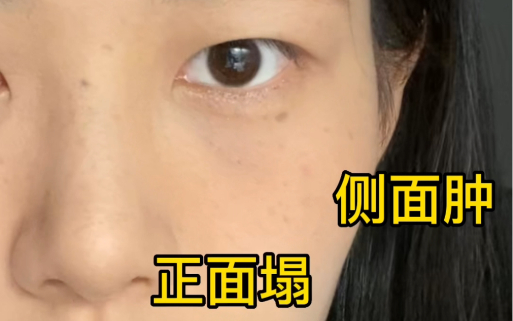 内双肿眼泡眼妆常见雷区 消肿放大正确思路 哔哩哔哩