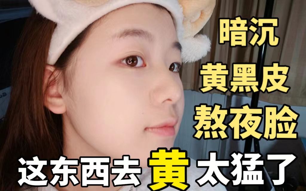我真不敢相信现在这脸只是一瓶双抗就能拥有的！ 哔哩哔哩