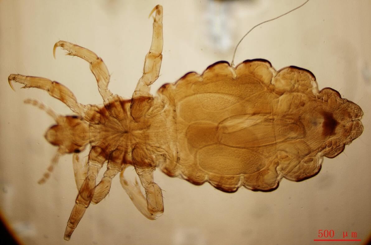 昆虫的足各色各样，那它们的足都有些什么功能和作用呢？ - 哔哩哔哩