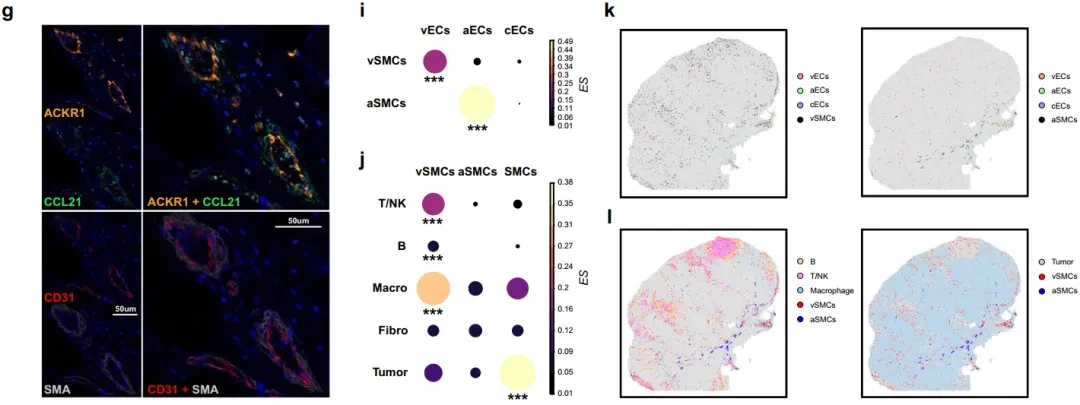 Nat Commun | Stereo-seq助力绘制乳腺癌空间图谱，揭示免疫浸润的微静脉调节机制 - 哔哩哔哩