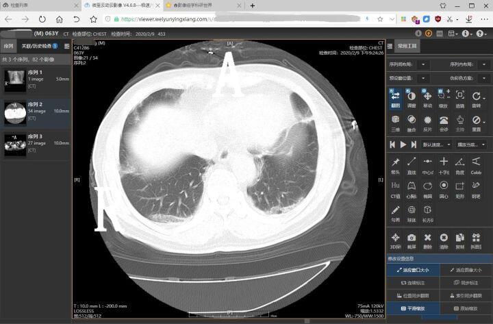 分享八个各有优势的 DICOM 图像阅读和科研处理软件（附 Radiant Viewer 免激活版） - 哔哩哔哩