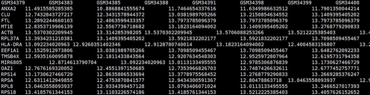 高分生信文章最受欢迎的免疫浸润分析算法-CIBERSORT - 哔哩哔哩
