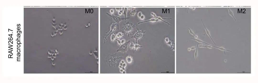 细胞学堂 | RAW 264.7诱导极化及鉴定大全 - 哔哩哔哩