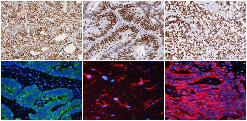 IHC免疫组化技术应用 - 哔哩哔哩