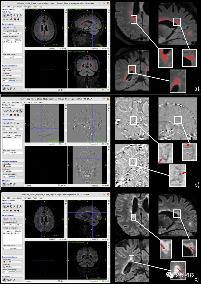 BMAT：一个开源的BIDS管理和分析工具 - 哔哩哔哩