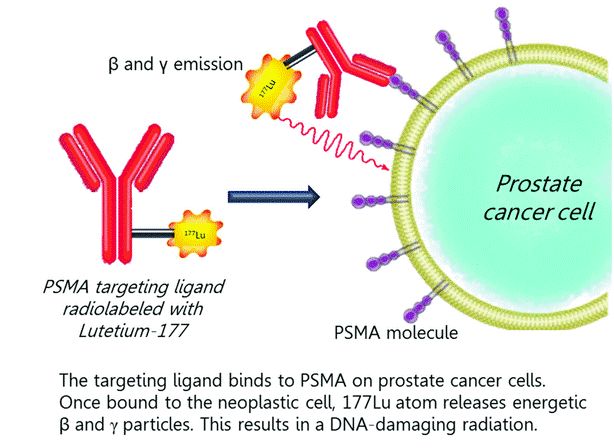 Pluvicto前列腺癌靶向治疗新一代核武器 求臻医学探泌臻知 - 哔哩哔哩