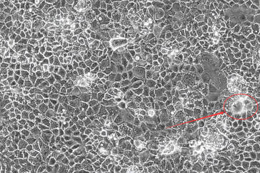 人结直肠腺癌细胞(Caco-2)培养要点 - 哔哩哔哩