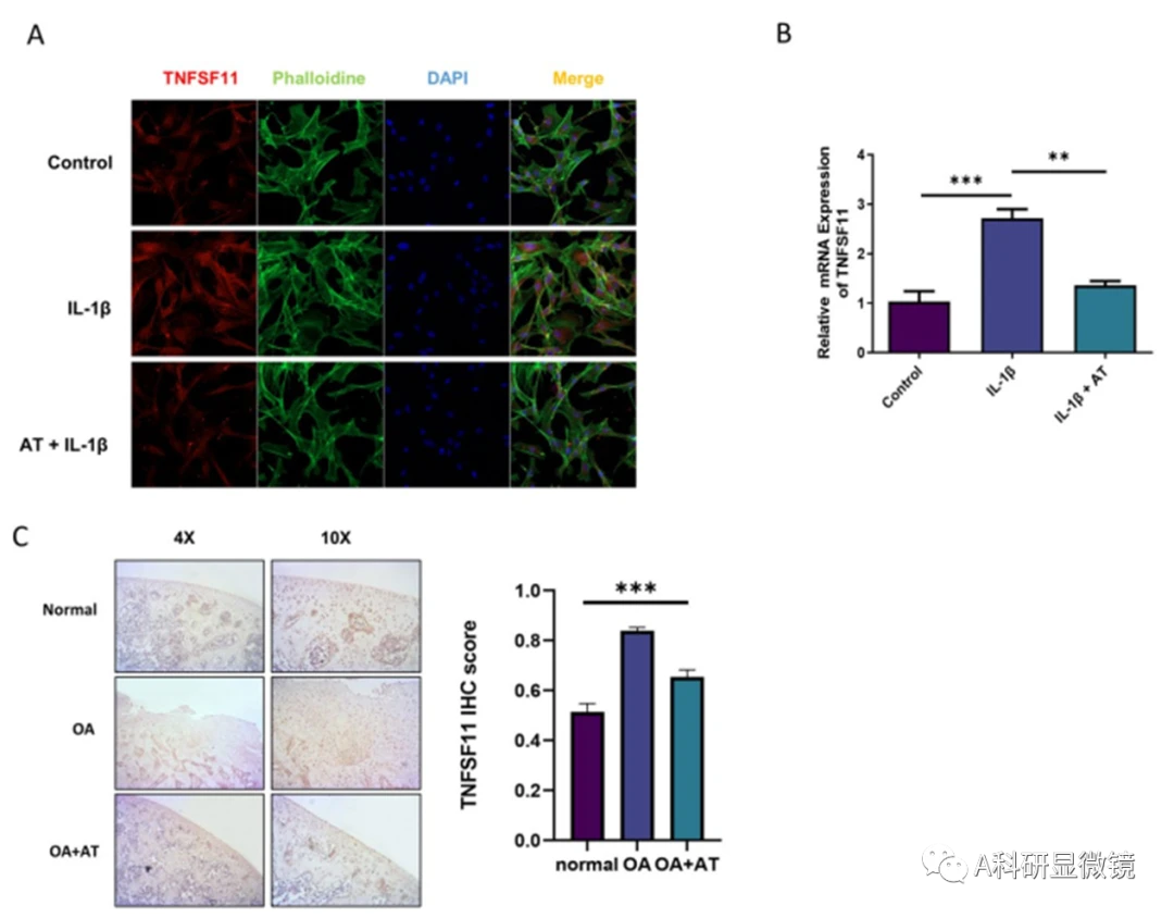 紧跟国自然热点“自噬”，解密药物作用机制：一篇8+文献的实验设计思路，快来复现吧 - 哔哩哔哩