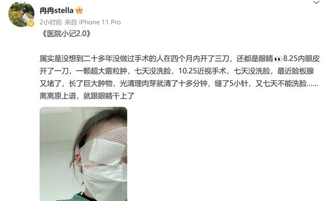 RNG官宣大名单赛训组大换，tabe老婆晒3次术后照，眼睛蒙厚厚纱布 - 哔哩哔哩