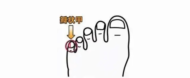 小脚趾拥有两瓣的人到底是不是纯种汉人？是鲜卑一族 哔哩哔哩
