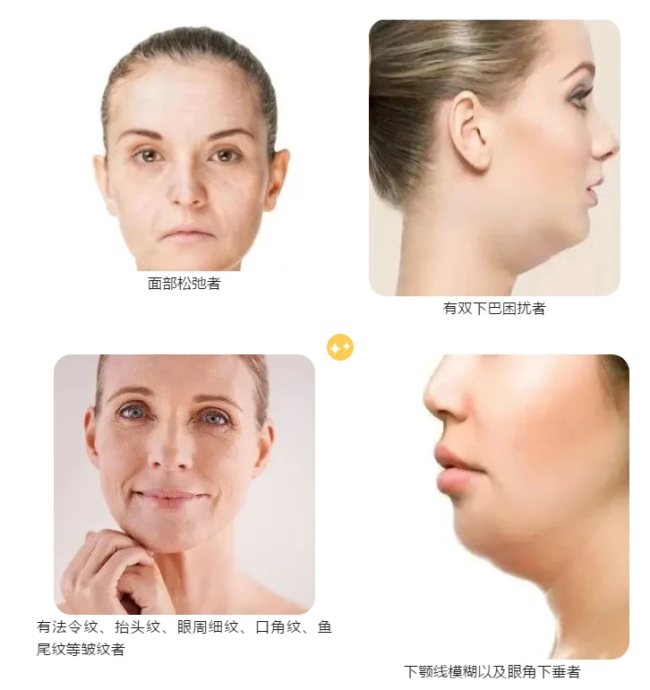 真实反馈——超声炮效果怎么样?超声炮可以做哪些部位? 哔哩哔哩