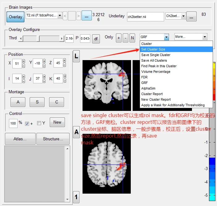 dpabi处理fmri数据、统计分析和可视化、提取roi - 哔哩哔哩
