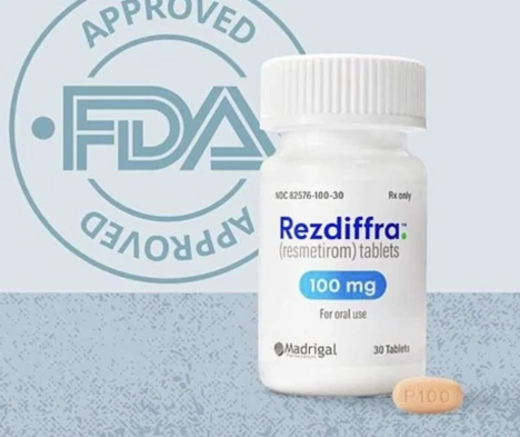 瑞色替罗/瑞司美替罗(Rezdiffra/Resmetirom)获FDA批准治疗非酒精性脂肪肝 - 哔哩哔哩