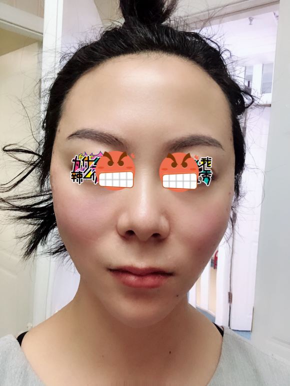 超声炮做一次的费用,超声炮的效果如何 哔哩哔哩