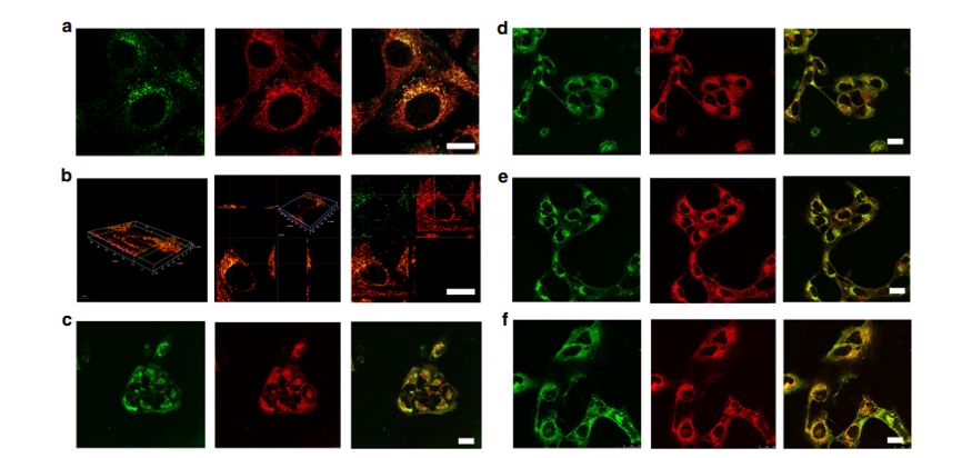 NIRⅡ-RT-ATP探针；线粒体靶向NIR-Ⅱ荧光探针；新型近红外染料 NIRⅡ-RT3/4定制 - 哔哩哔哩