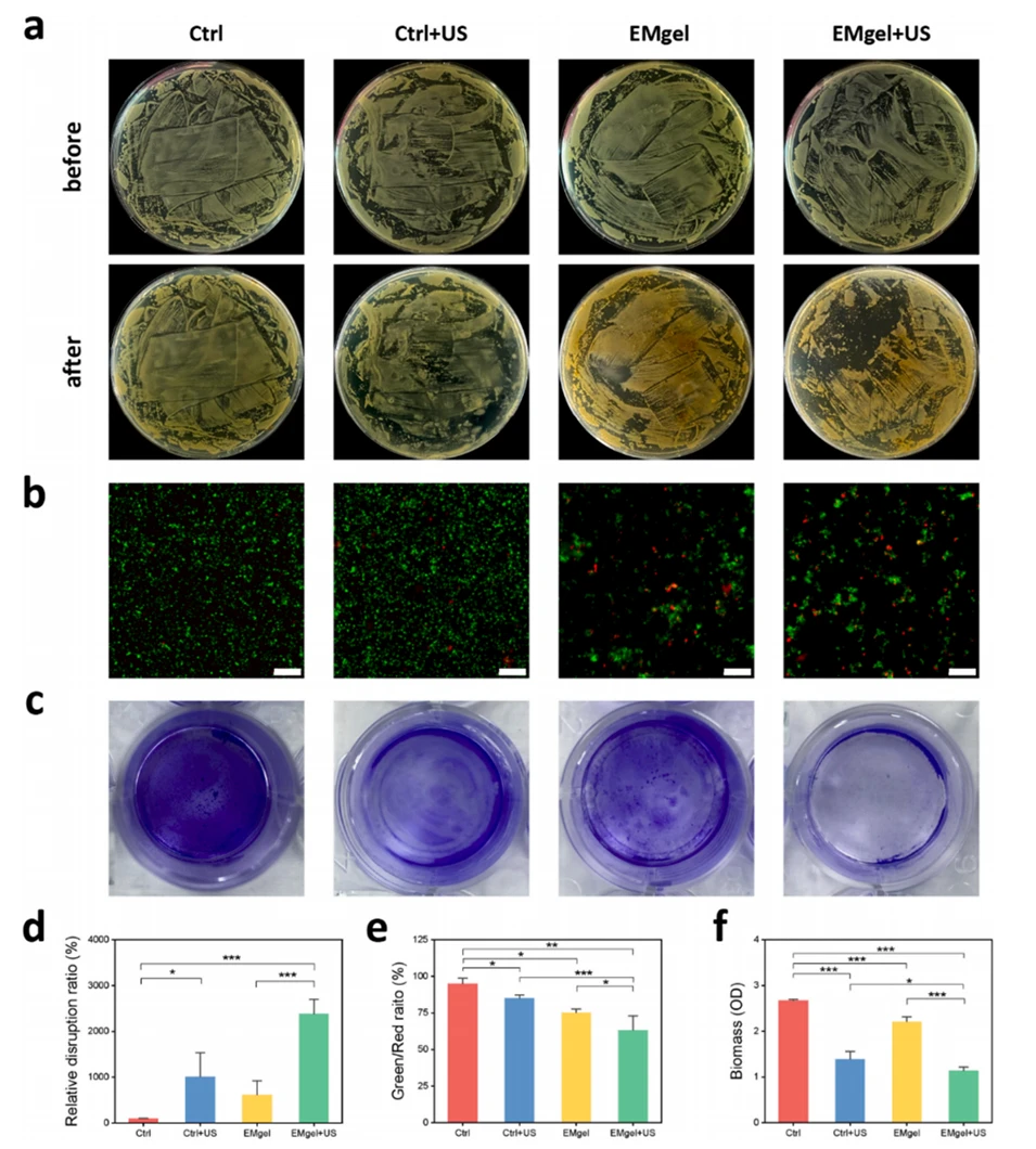 南方医科大学王平/广东省科学院生物与医学工程研究所曾志文：可注射水凝胶微球“炸弹 - 哔哩哔哩
