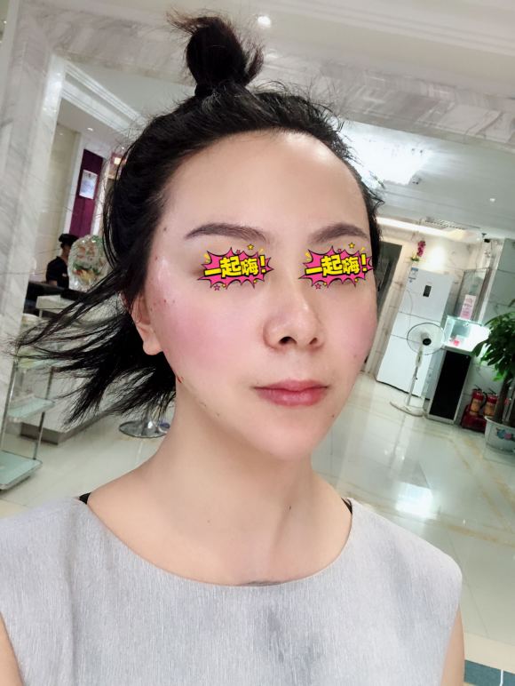 超声炮做一次的费用,超声炮的效果如何 哔哩哔哩