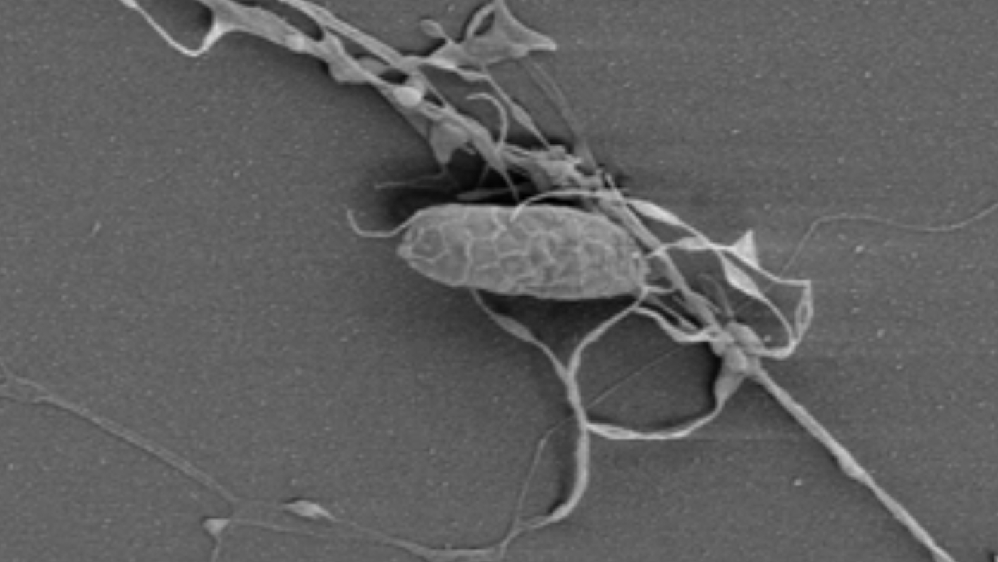 色藻界E02：双环门（Bigyra）和卵菌门（Oomycota） - 哔哩哔哩