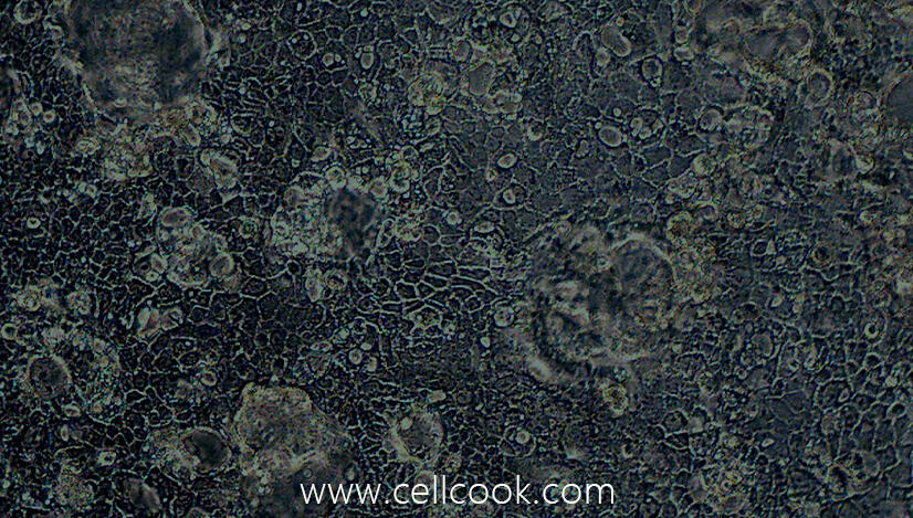 细胞学堂|Caco-2人结直肠腺癌细胞的生长特性及常见问题 - 哔哩哔哩