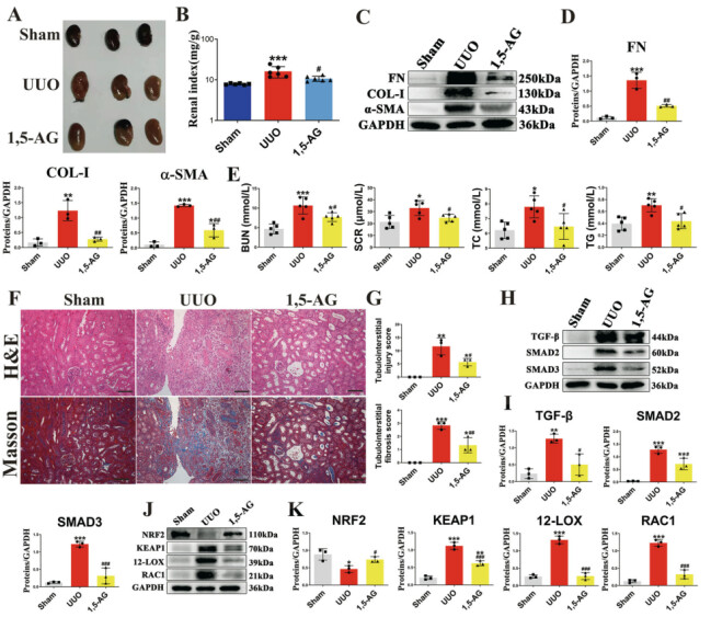 IF=17.694 | 肠道微生物脆弱拟杆菌改善小鼠肾纤维化 - 哔哩哔哩