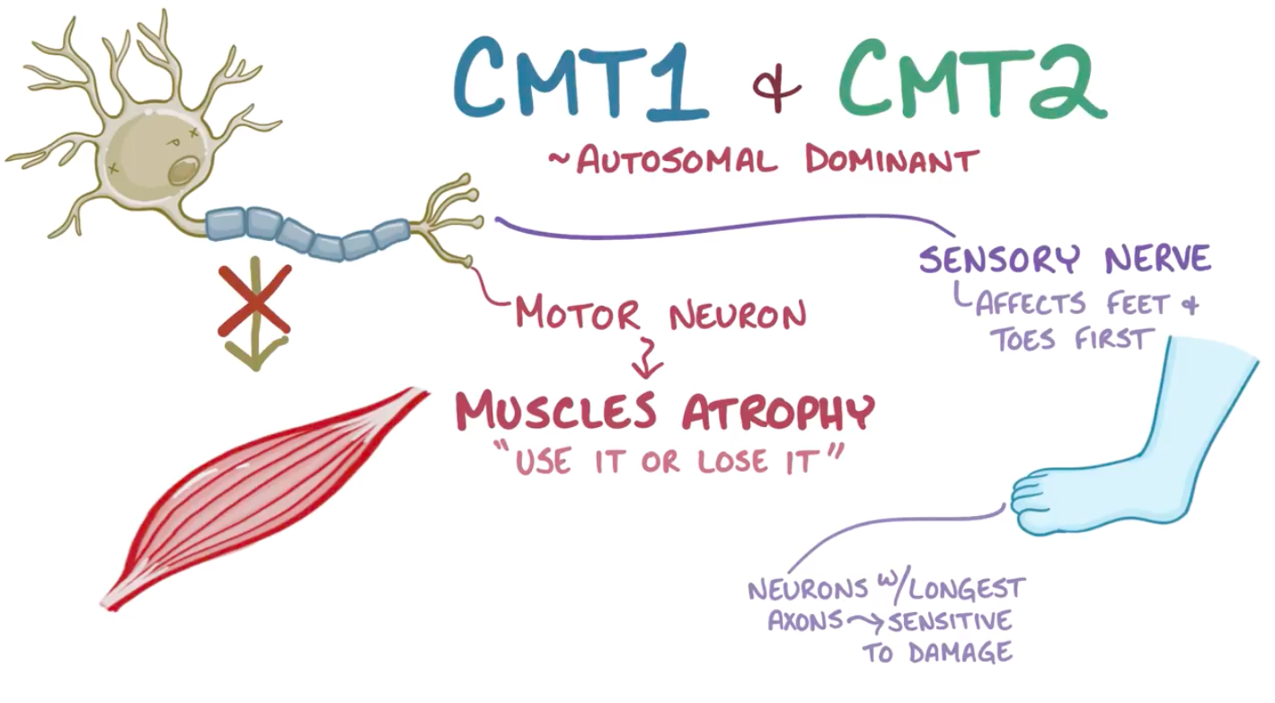 【Osmosis医学】腓骨肌萎缩症 Charcot-Marie-Tooth Disease - 哔哩哔哩