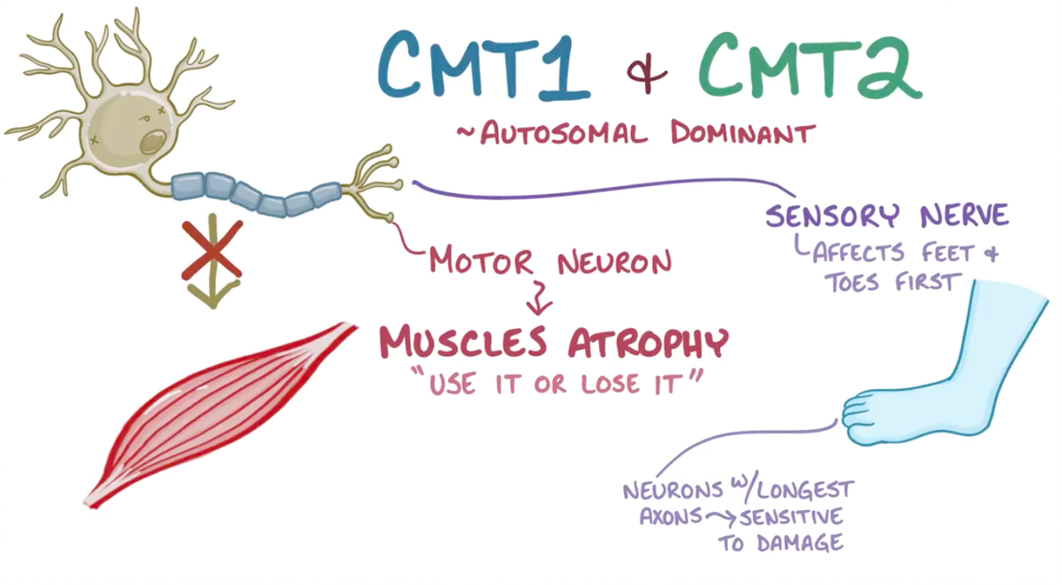 【Osmosis医学】腓骨肌萎缩症 Charcot-Marie-Tooth Disease - 哔哩哔哩