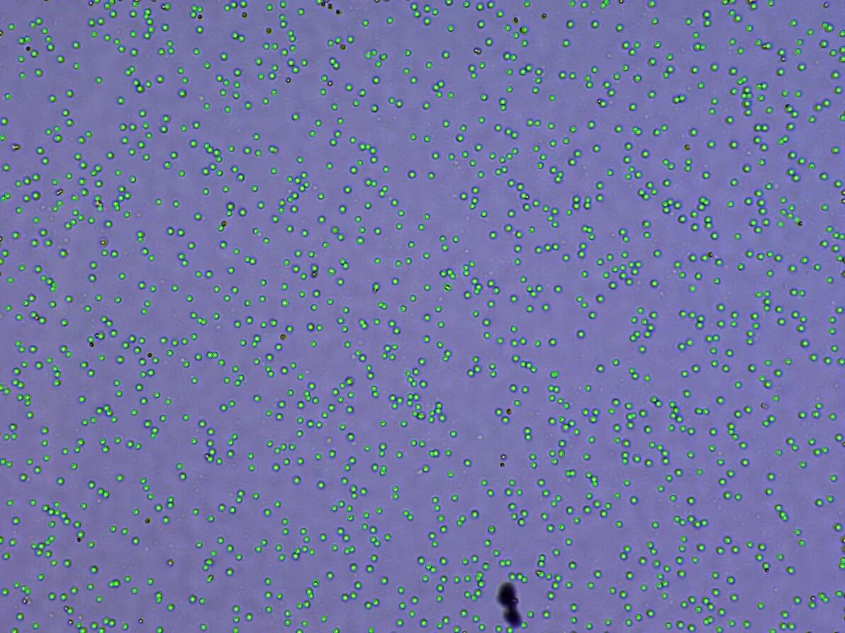细胞系列【1】PBMC细胞的解读 - 哔哩哔哩