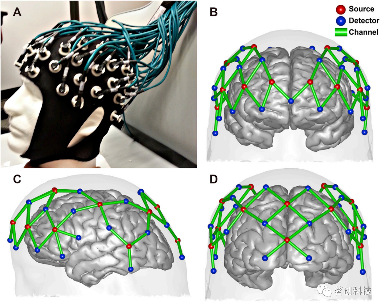 含教程 | 时间导数分布修复(TDDR)：fNIRS运动校正方法 - 哔哩哔哩
