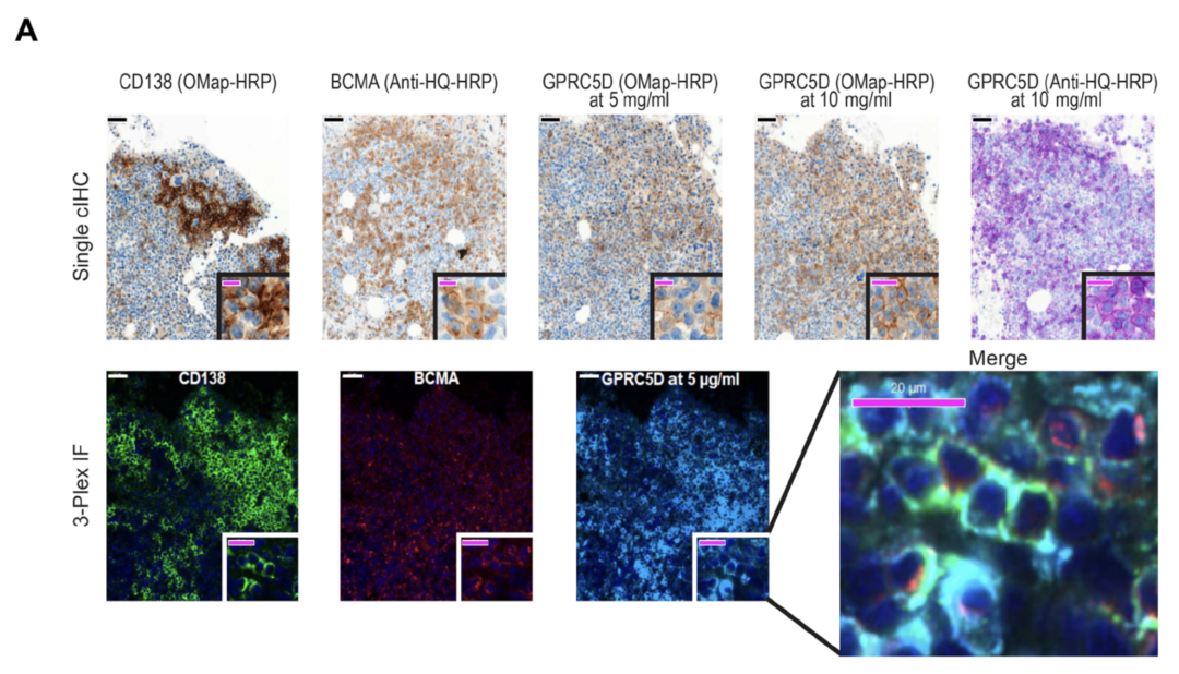 从GPRC5D看CAR-T靶点的发现与研究 - 哔哩哔哩