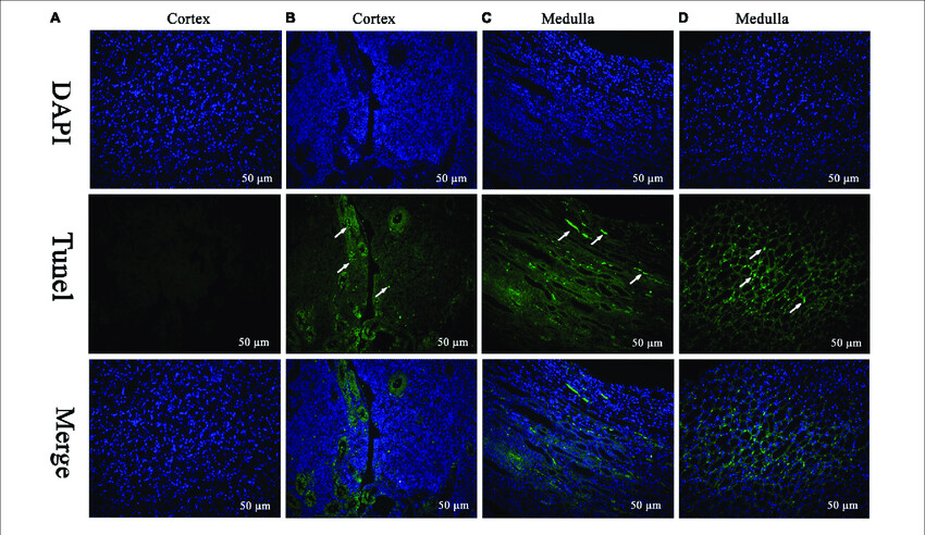 DNA损伤检测常用方法介绍 - 哔哩哔哩