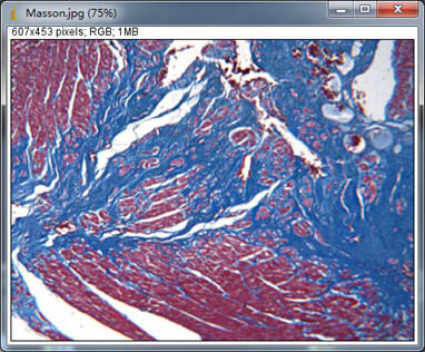 绘图干货丨老司机解带你解锁ImageJ面积分析 - 哔哩哔哩